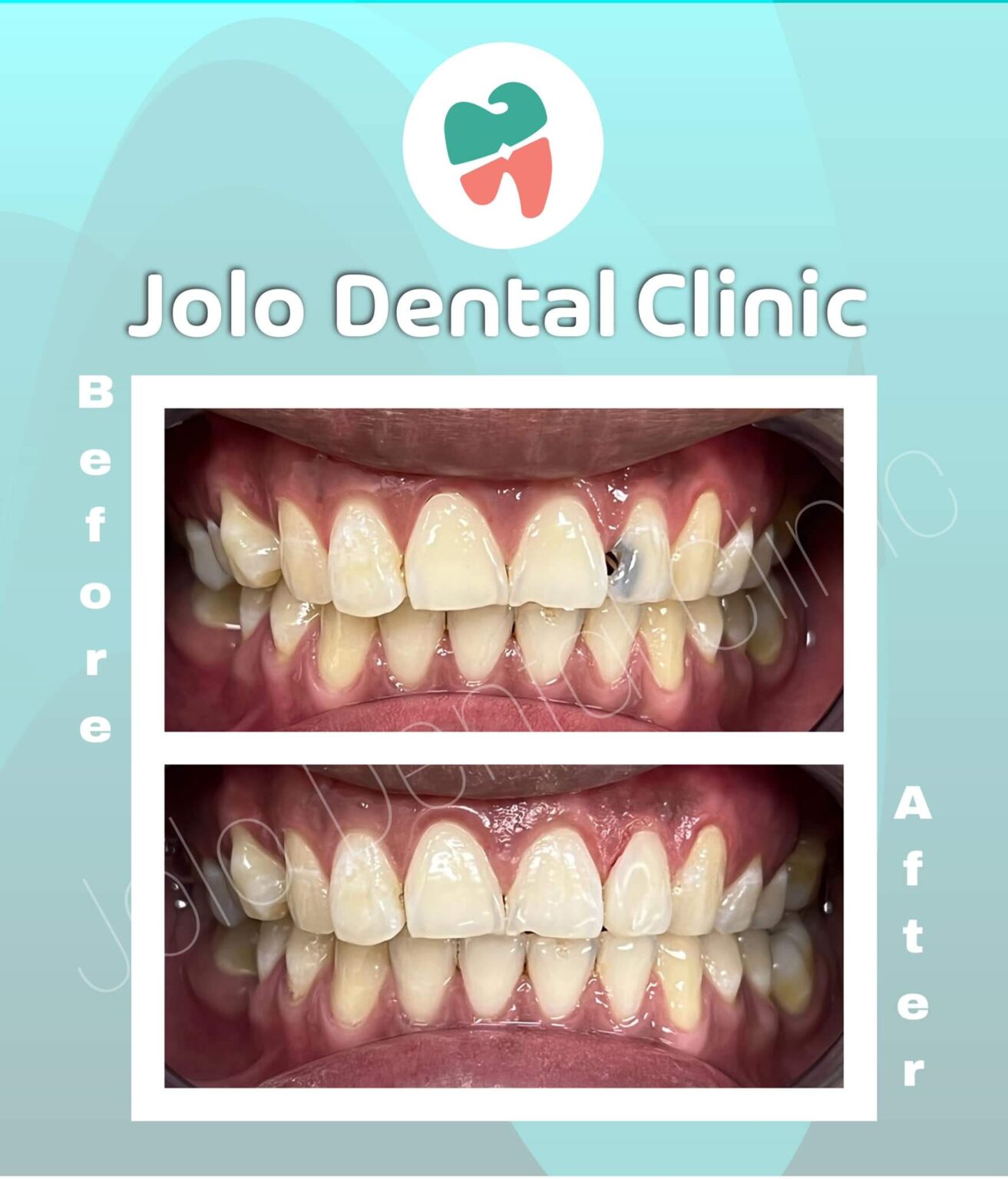 Affordable Dental Clinic In Cebu City - Jenneth Jolo-Rago Doctor of ...